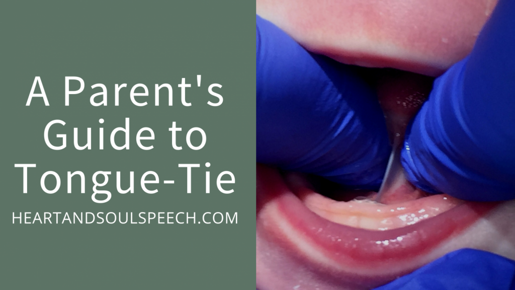 A Parent's Guide to Tongue-Tie – Heart & Soul Speech